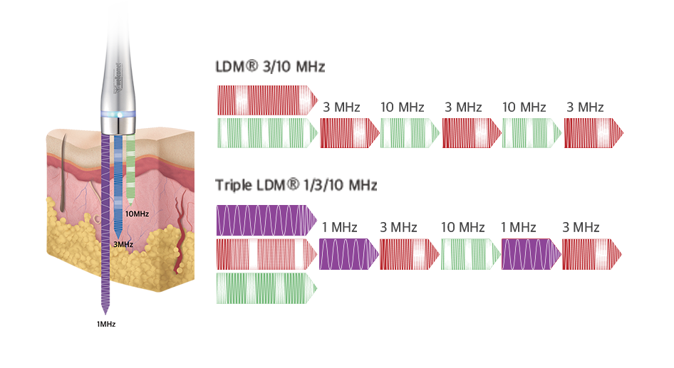 ANZ프리미엄관리 - 청담안즈피부과